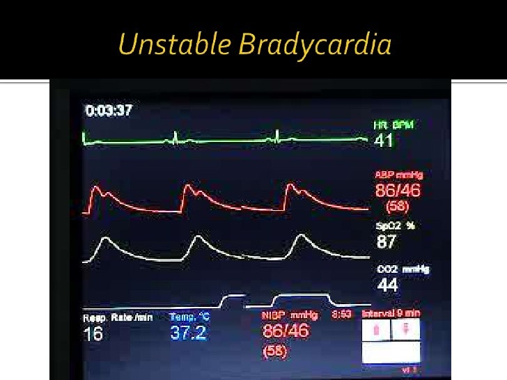 Management of bradycardia