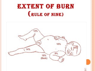 Management of burn in pediatric patients | PPT