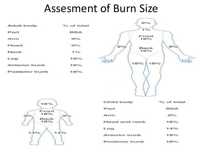Management of burns