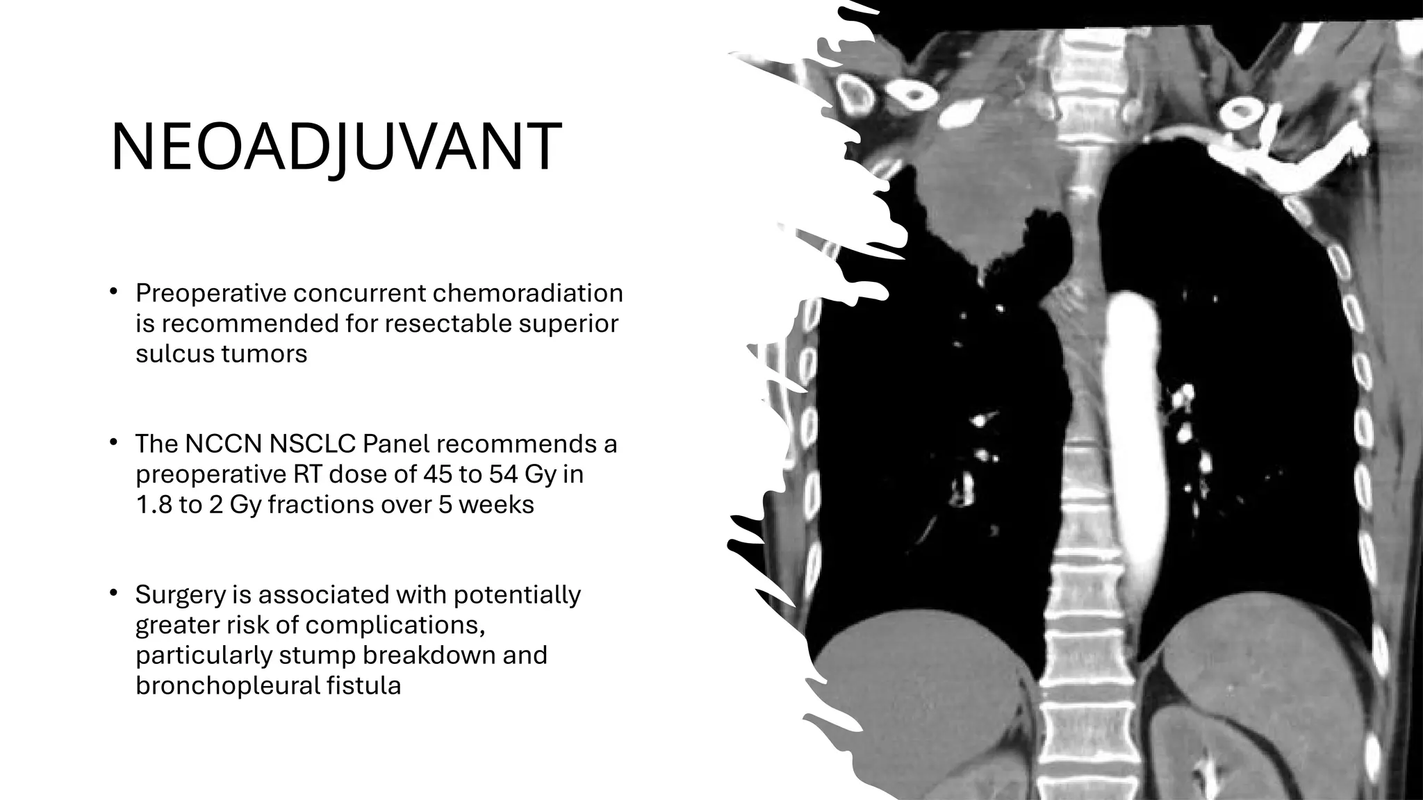MANAGEMENT OF CA LUNG - CHEMOTHERAPY, RADIOTHERAPY, SURGERY.pptx