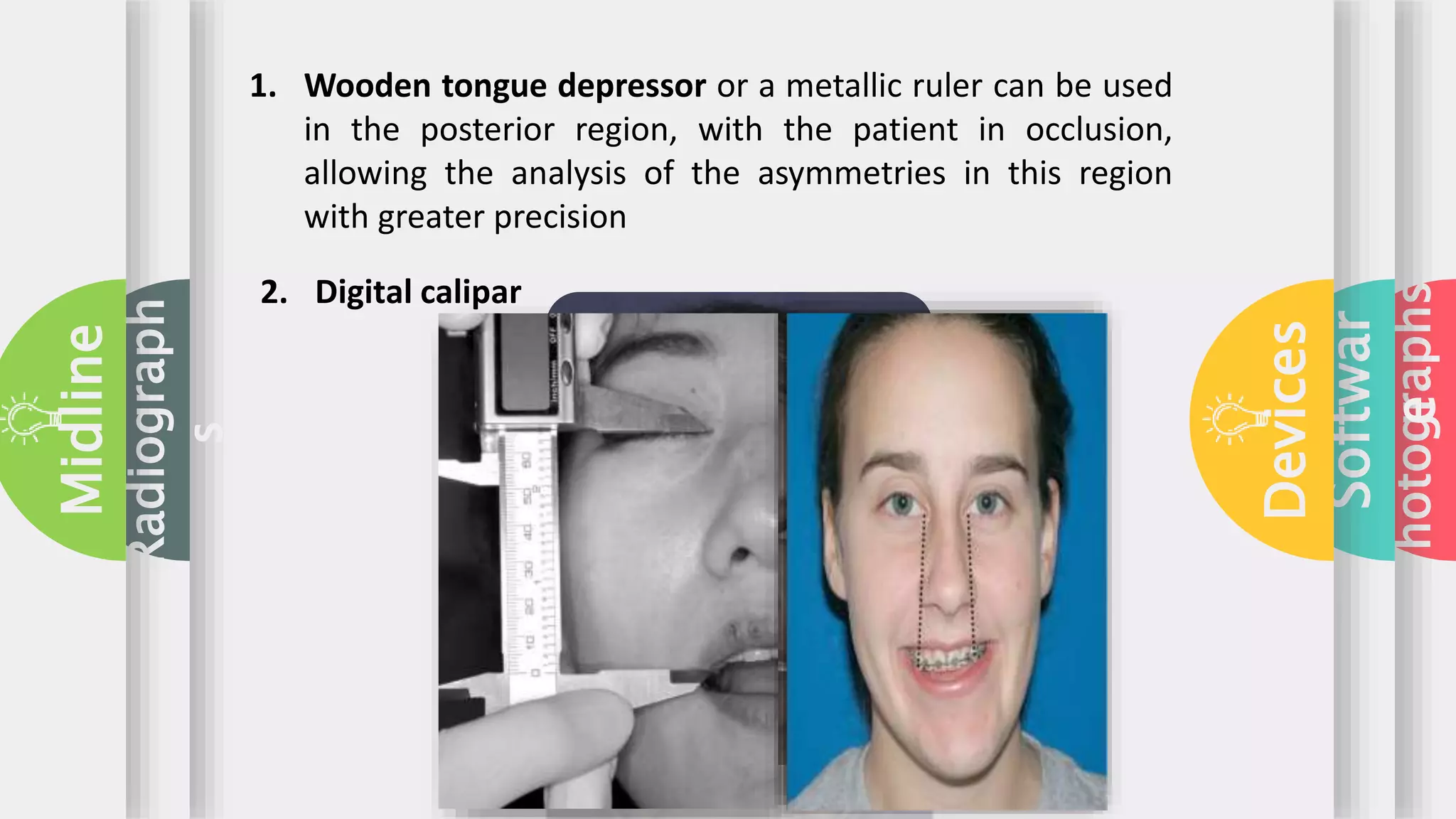 Management of Canted Occlusal plane in Orthodontics.pptx