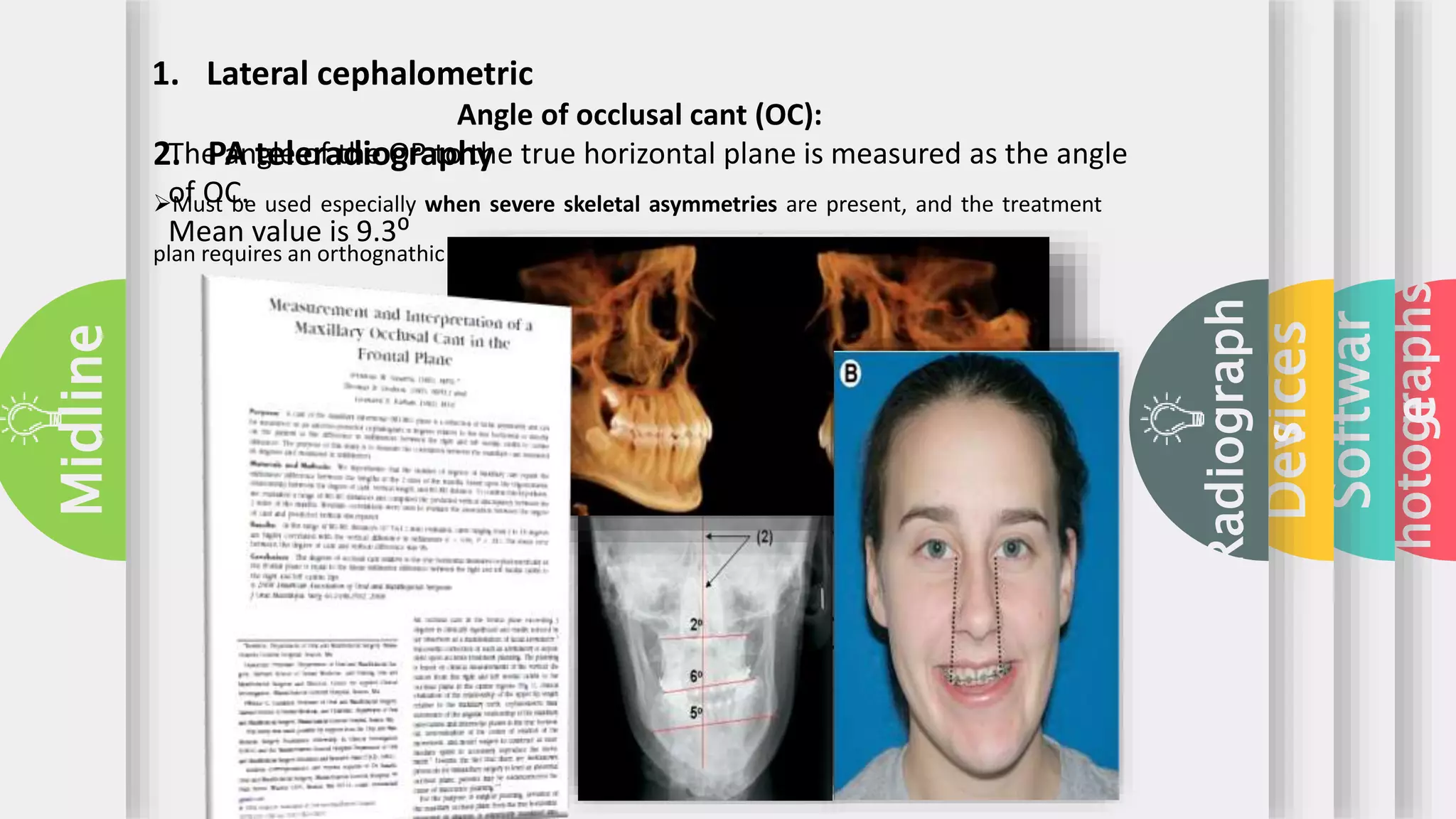 Management of Canted Occlusal plane in Orthodontics.pptx