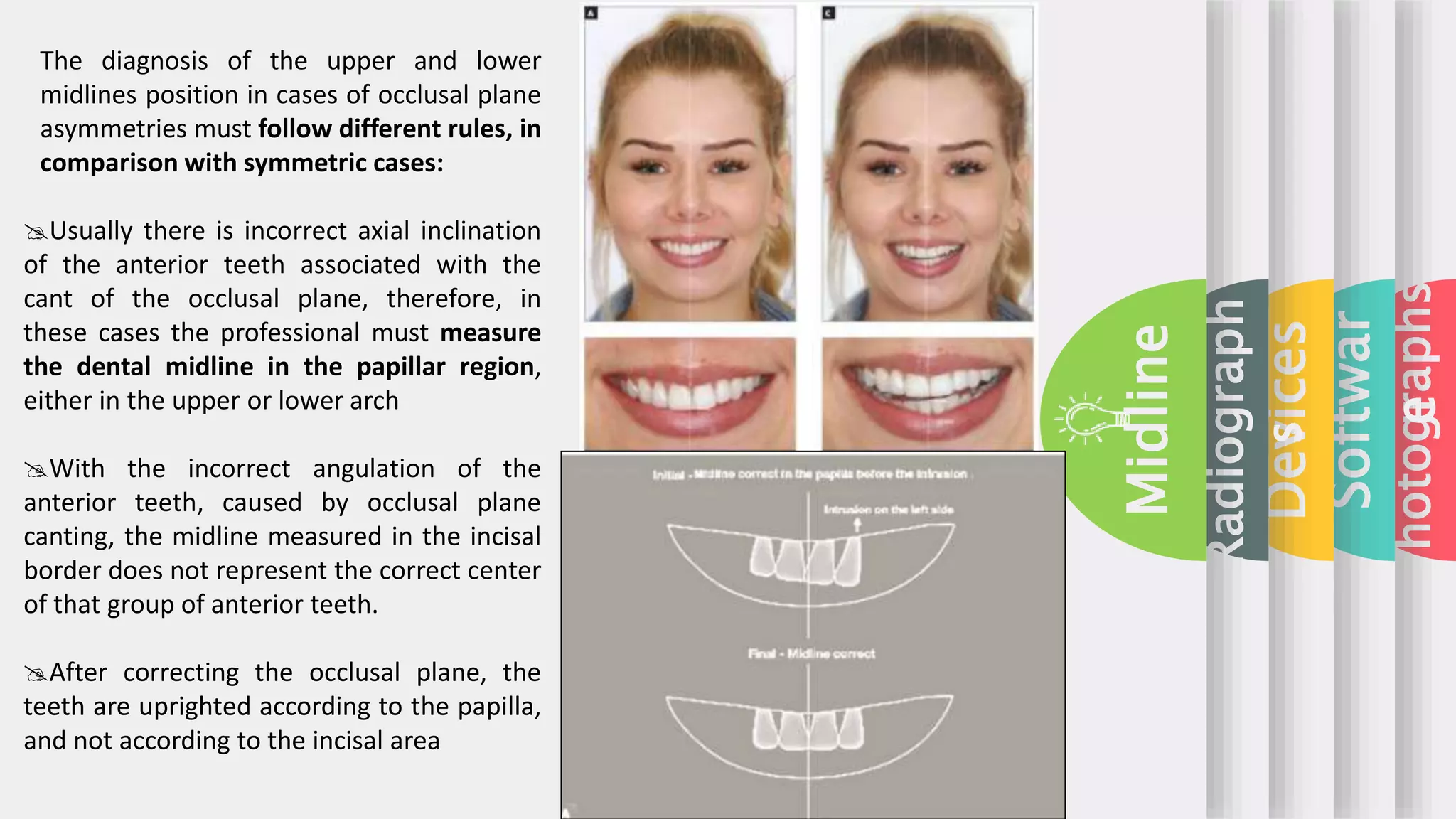 Management of Canted Occlusal plane in Orthodontics.pptx