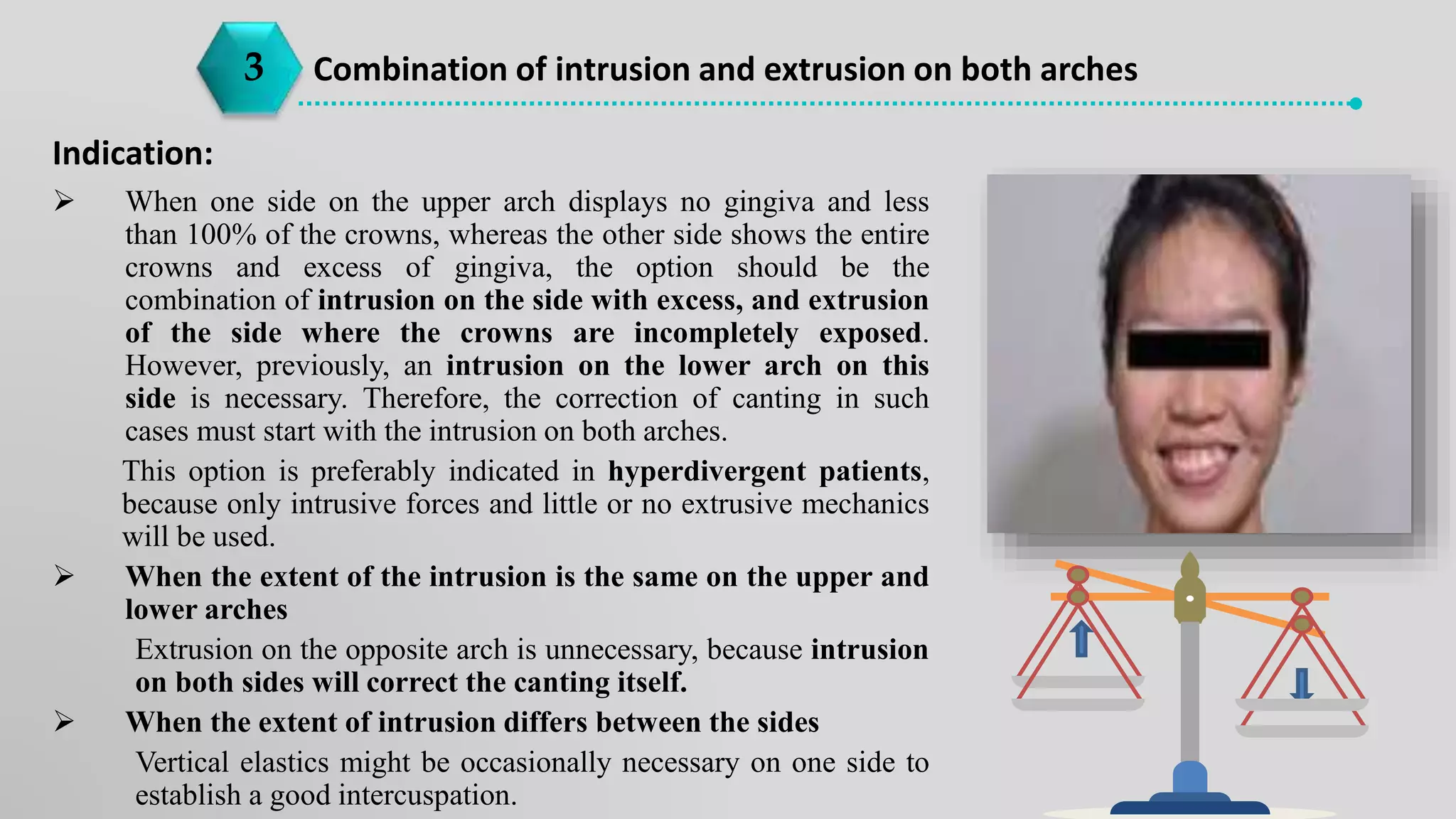 Management of Canted Occlusal plane in Orthodontics.pptx