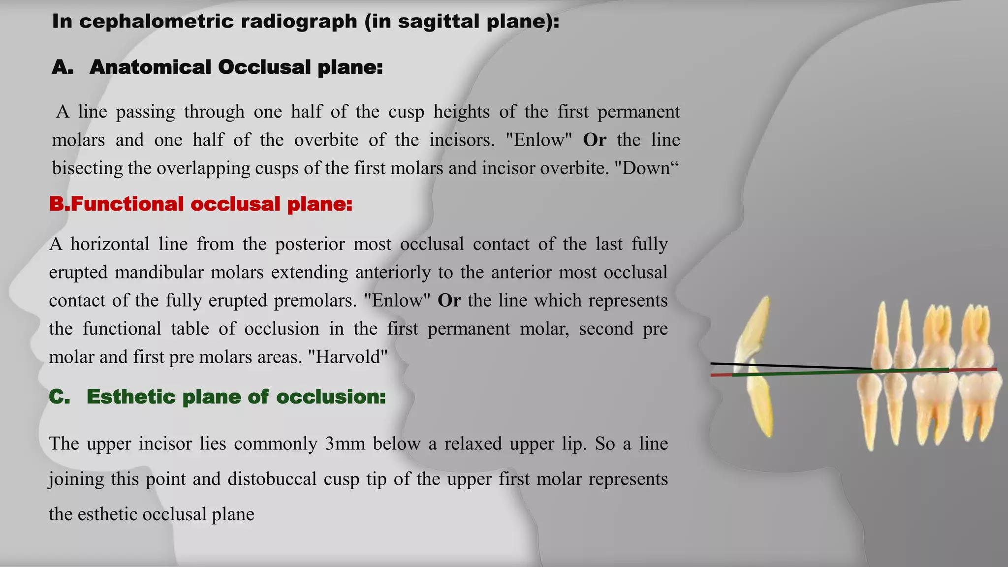 Management of Canted Occlusal plane in Orthodontics.pptx