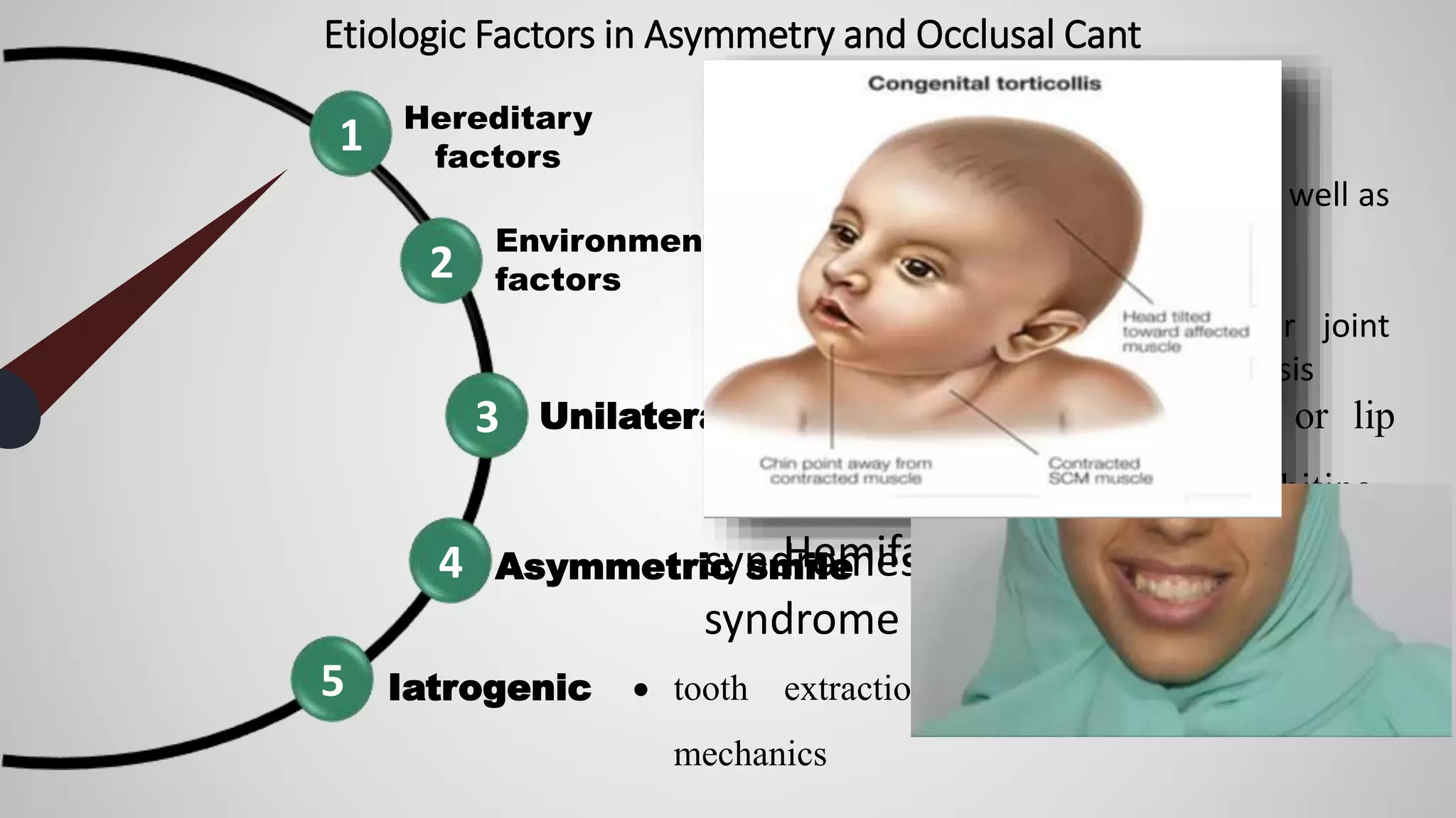 Management of Canted Occlusal plane in Orthodontics.pptx