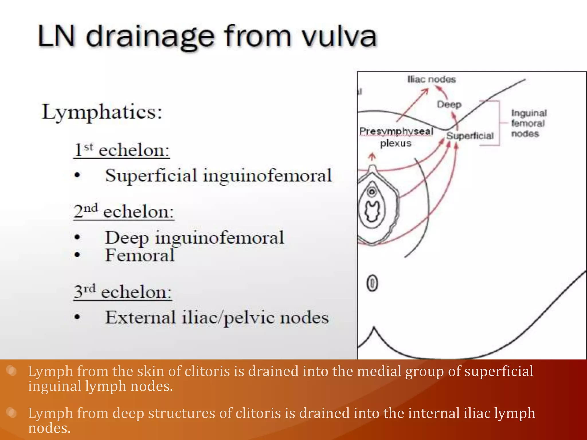 Management of carcinoma vulva | PPTX