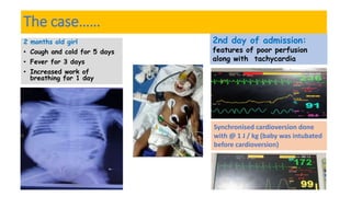 MANAGEMENT OF CARDIOGENIC SHOCK IN CHILDREN.pptx