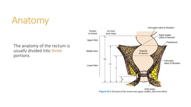 Management of Carcinoma Rectum.pptx | Cancer | Diseases and Conditions