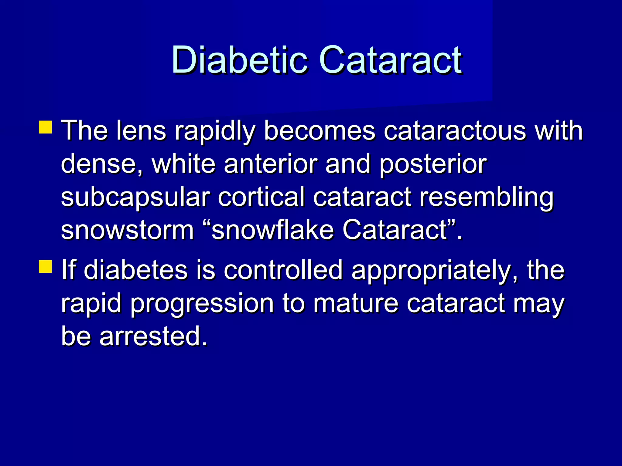 Management of cataract | PPT
