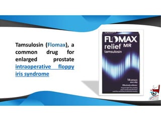 Management of Cataract.pptx