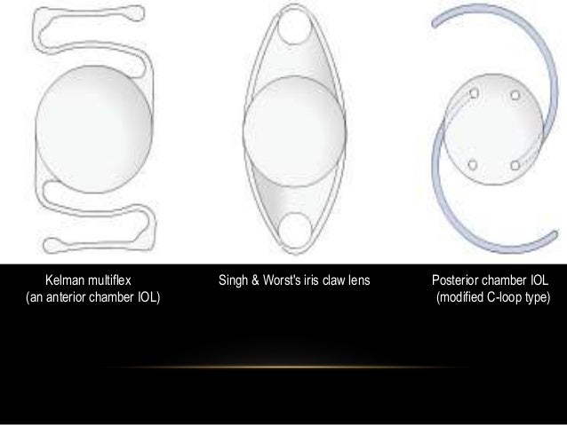 Management of Cataract