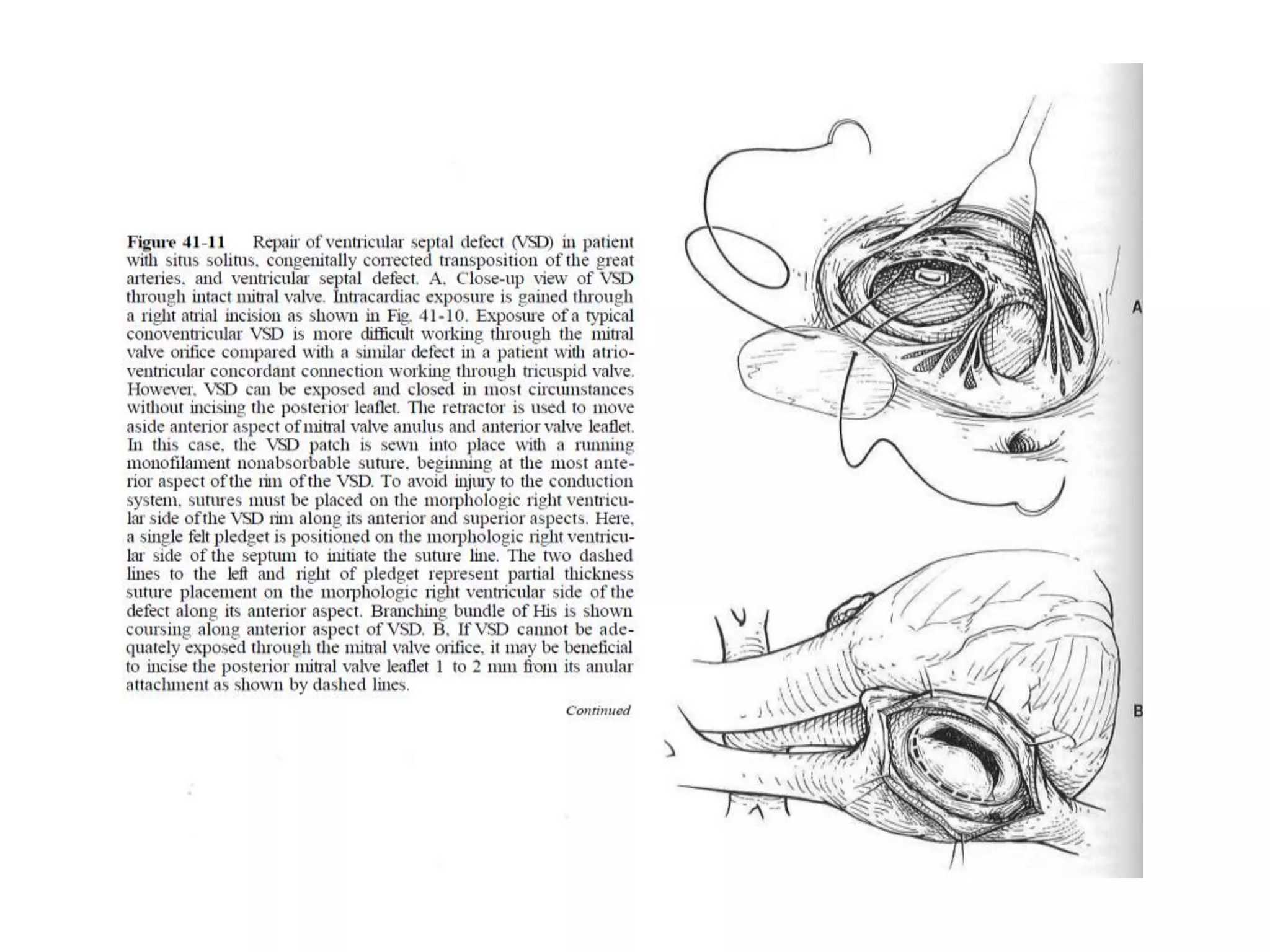 Management of cc tga | PPTX