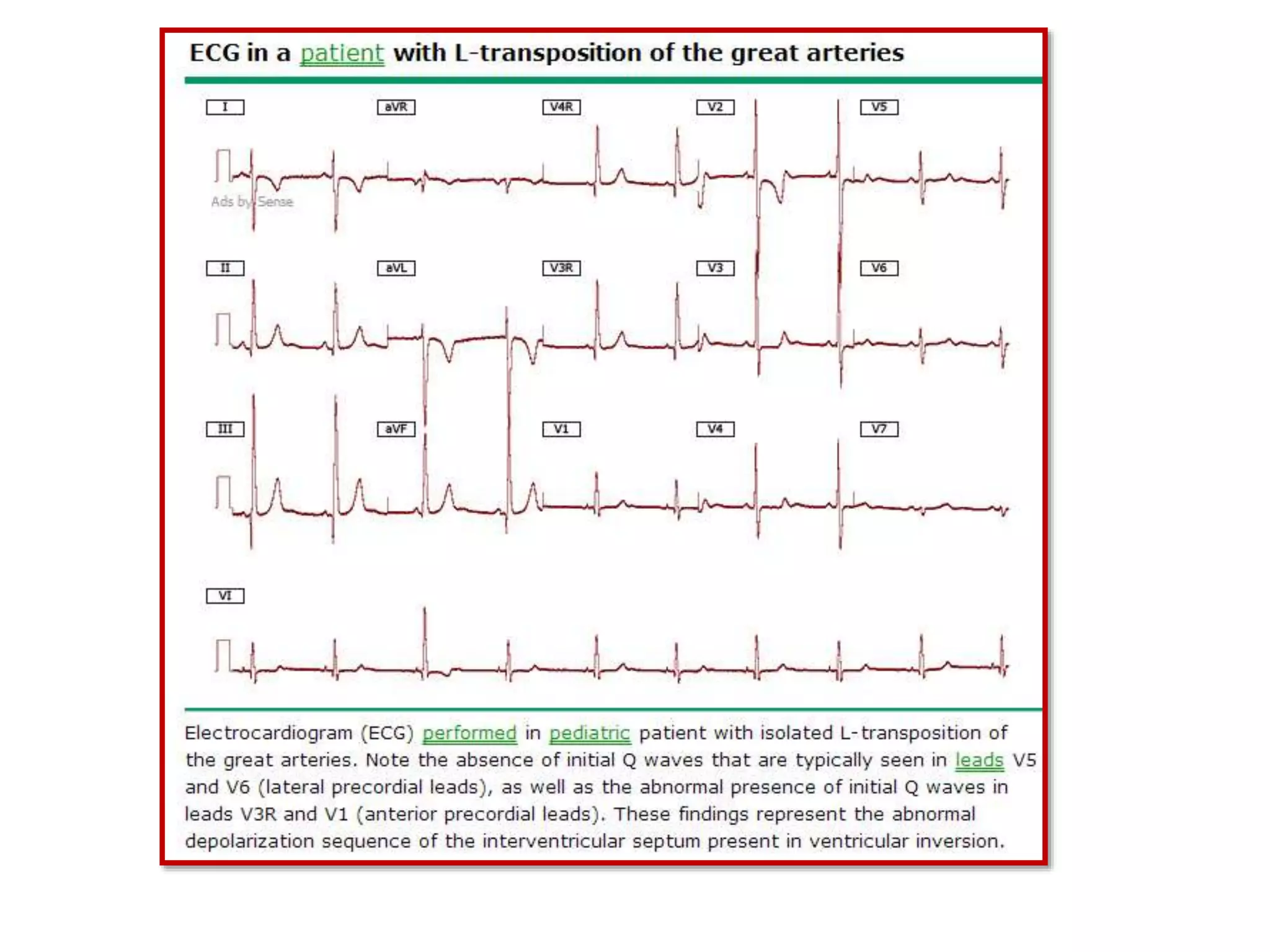 Management of cc tga | PPTX