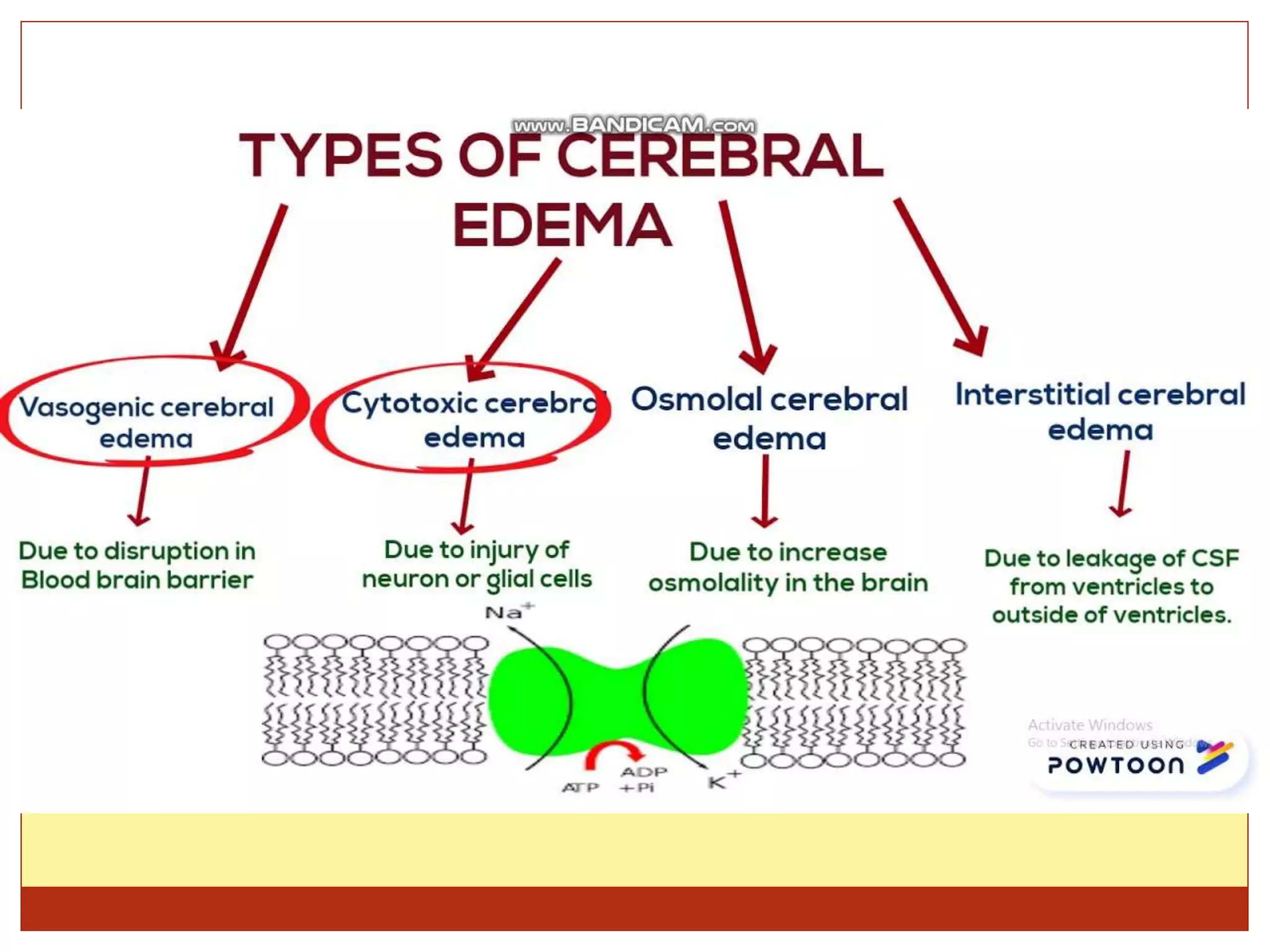 Management of Cerebral Edema in Brain Tumors | PPTX