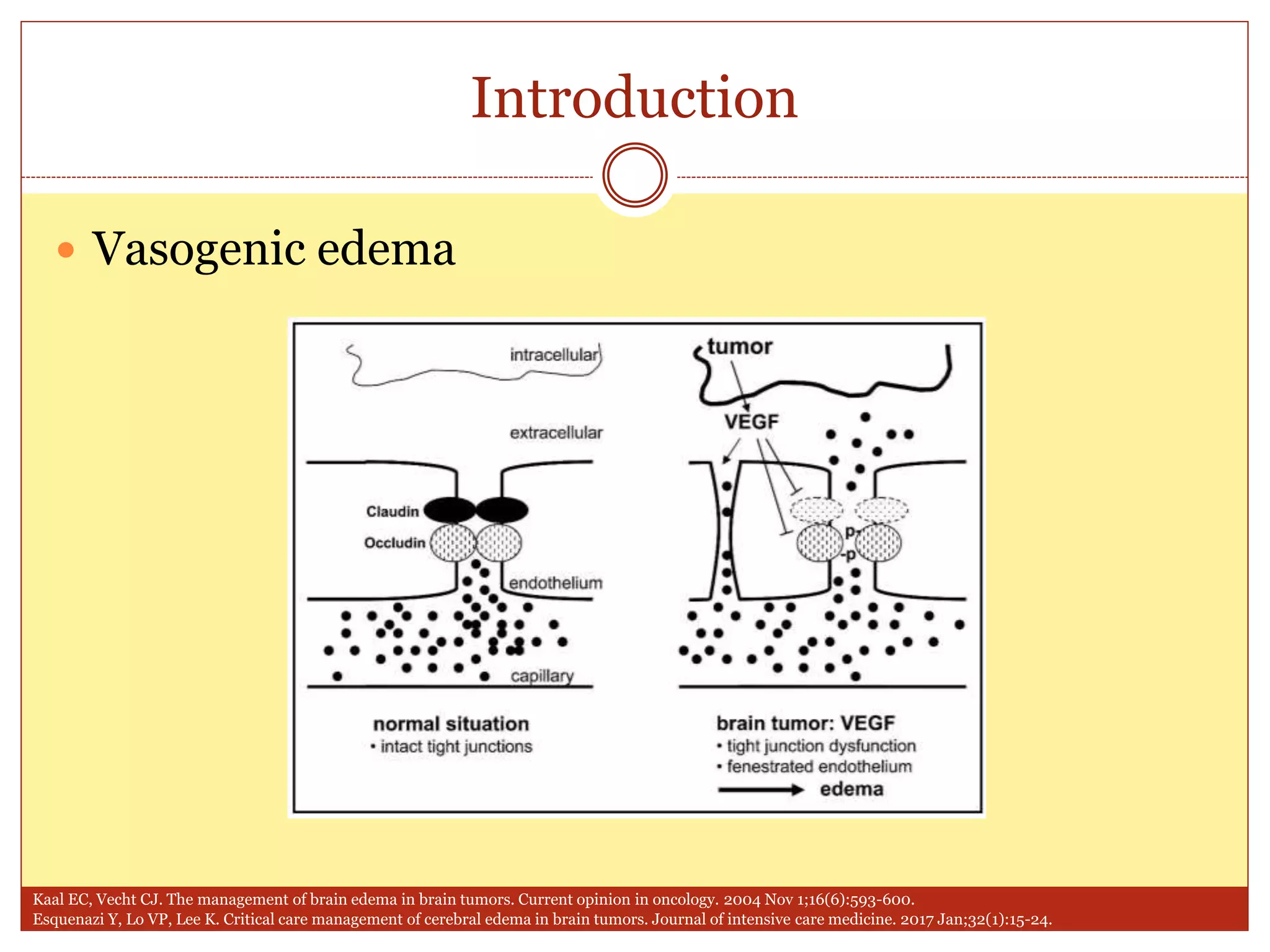 Management of Cerebral Edema in Brain Tumors | PPTX