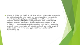 Management of Cerebral edema.pptx