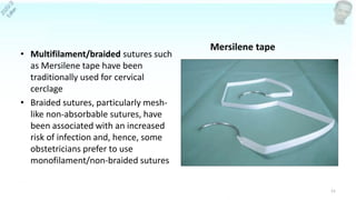 Management of cervical insufficiency | PPT
