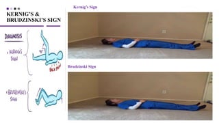 Management of child with meningitis.pptx