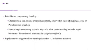 Management of child with meningitis.pptx