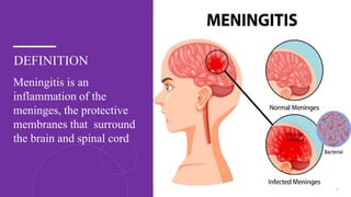 Management of child with meningitis.pptx