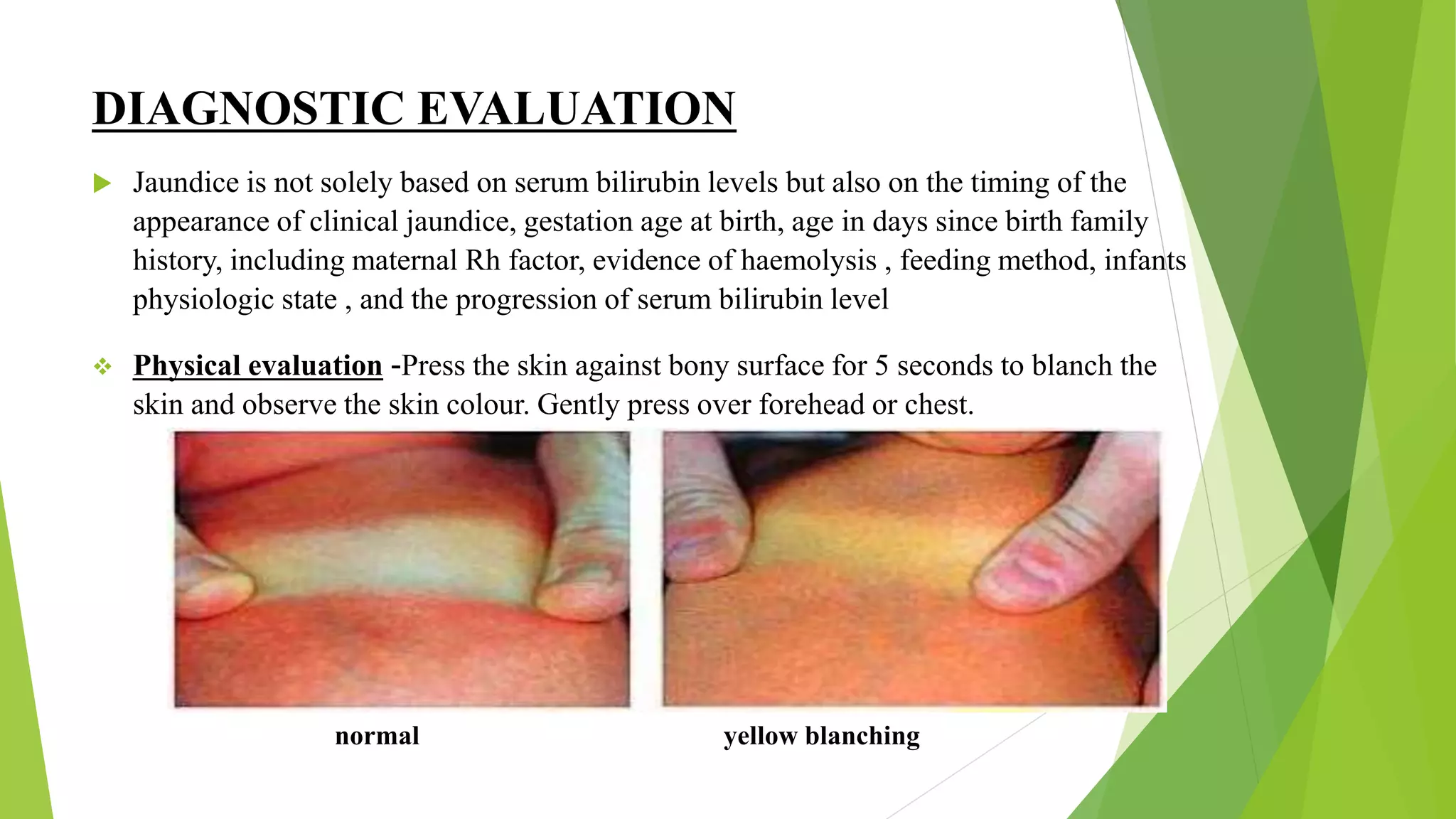 Management of child with neonatal jaundice | PPTX