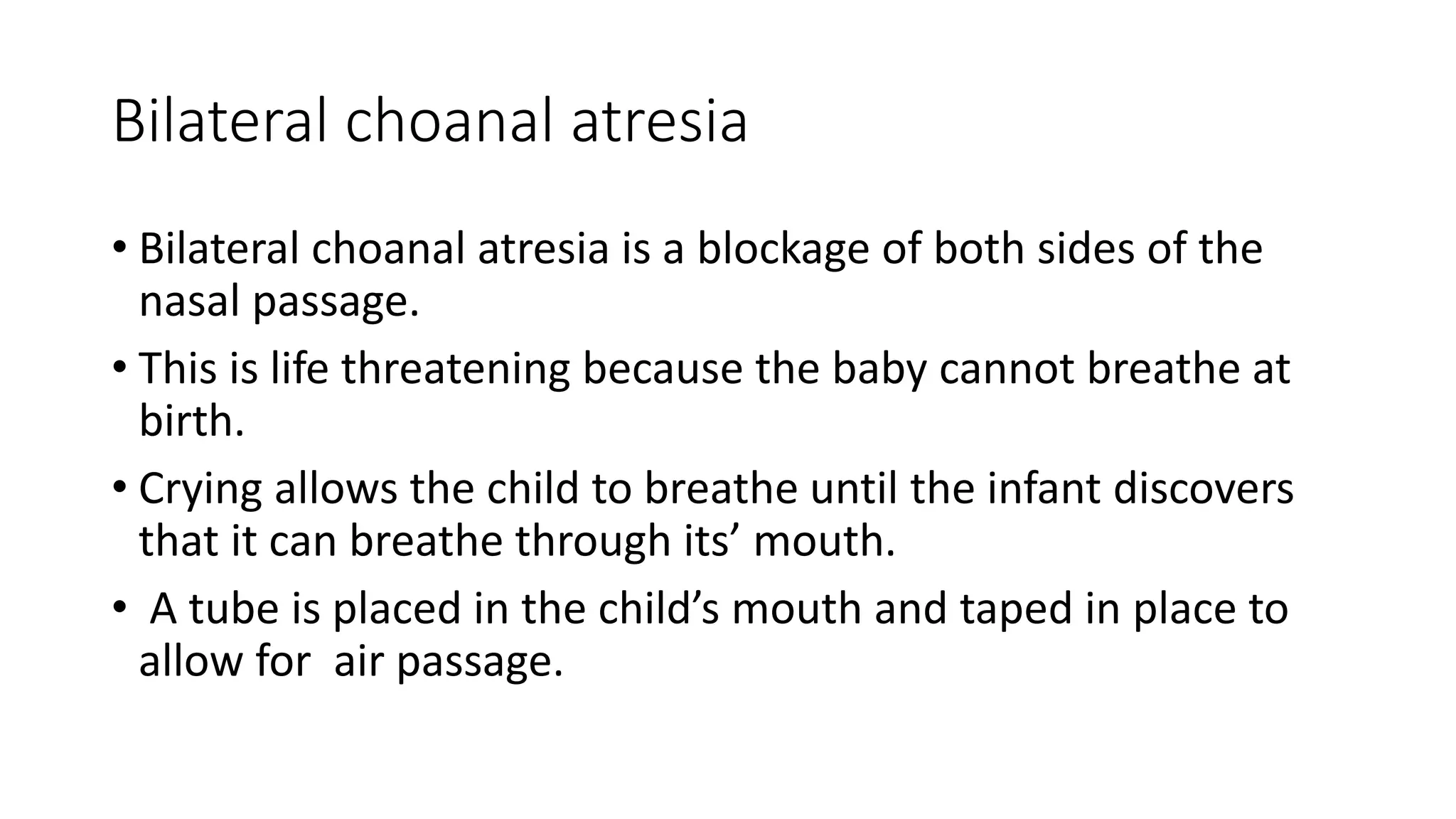 Management of choanal atresia | PPTX