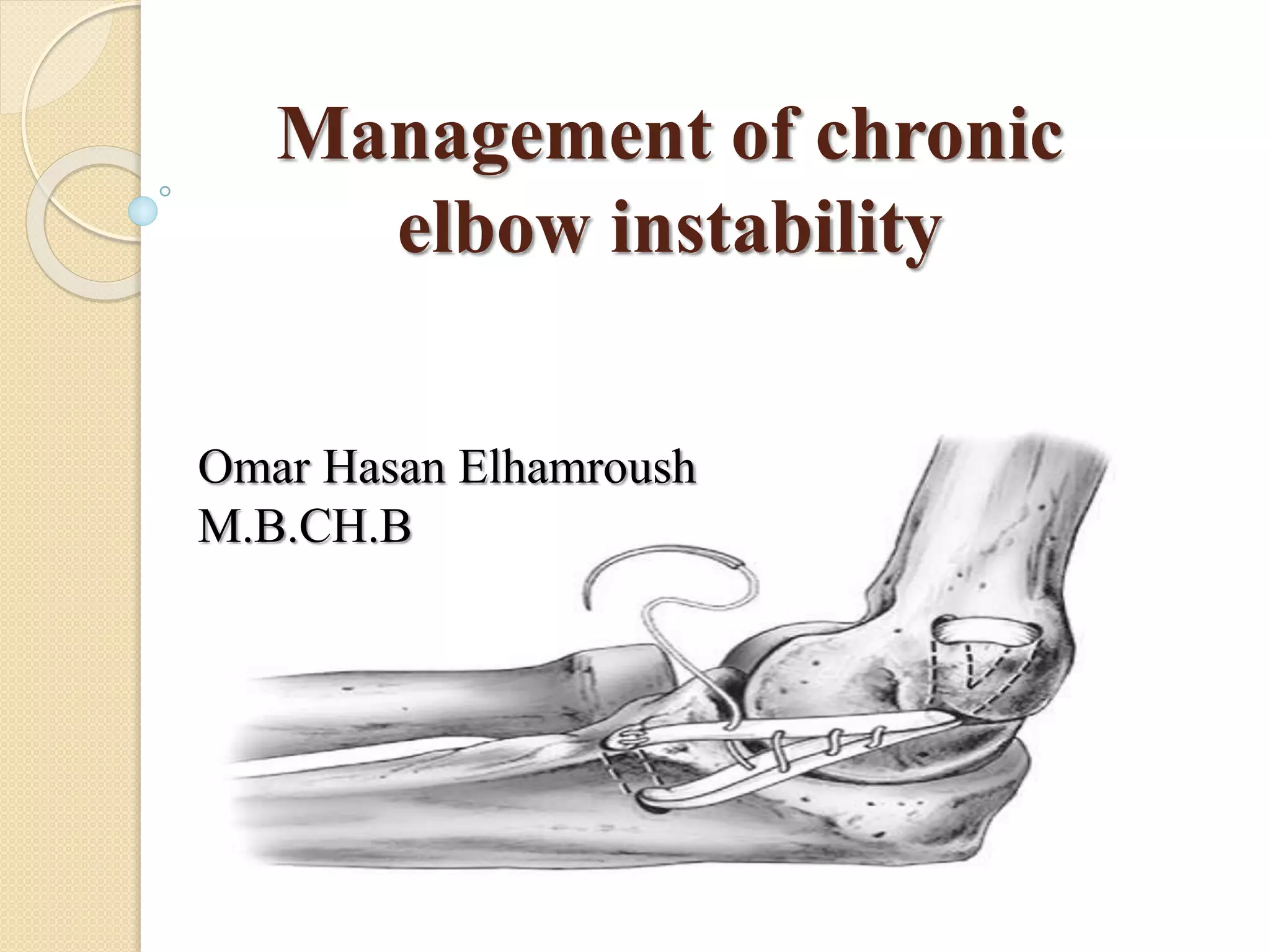 Management of chronic elbow instability 13 | PPTX