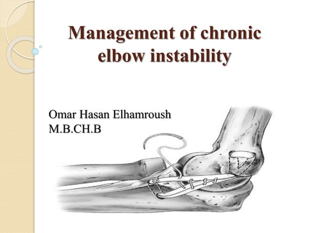 Management of chronic elbow instability 13 | PPTX