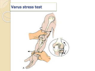 Elbow Varus Stress Test