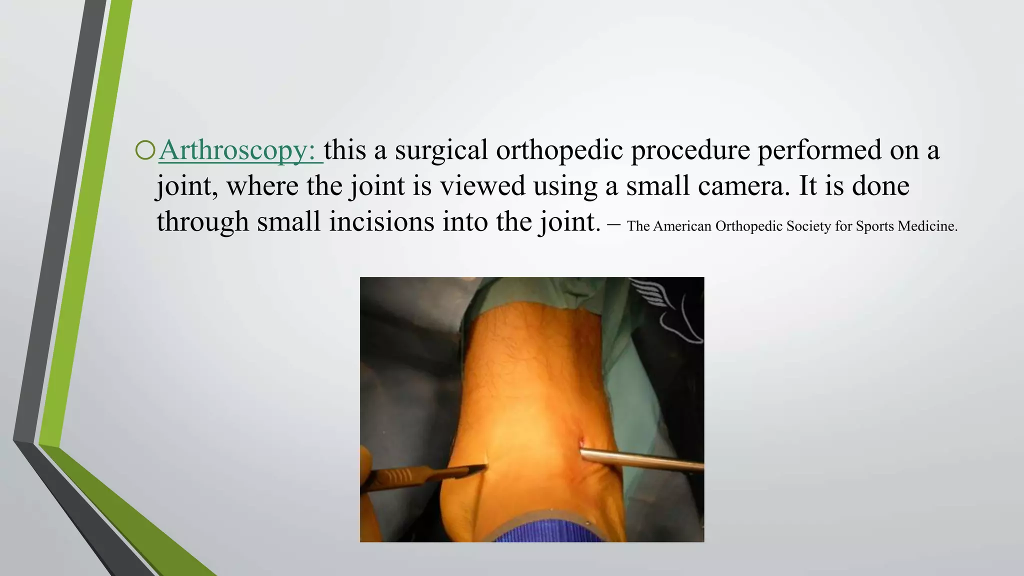 Arthroscopy: Management of chronic septic arthritis | PPT