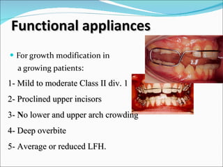 Management of class ii division 1 malocclusion | PPT