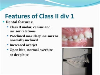 Management of class ii division 1 malocclusion | PPT