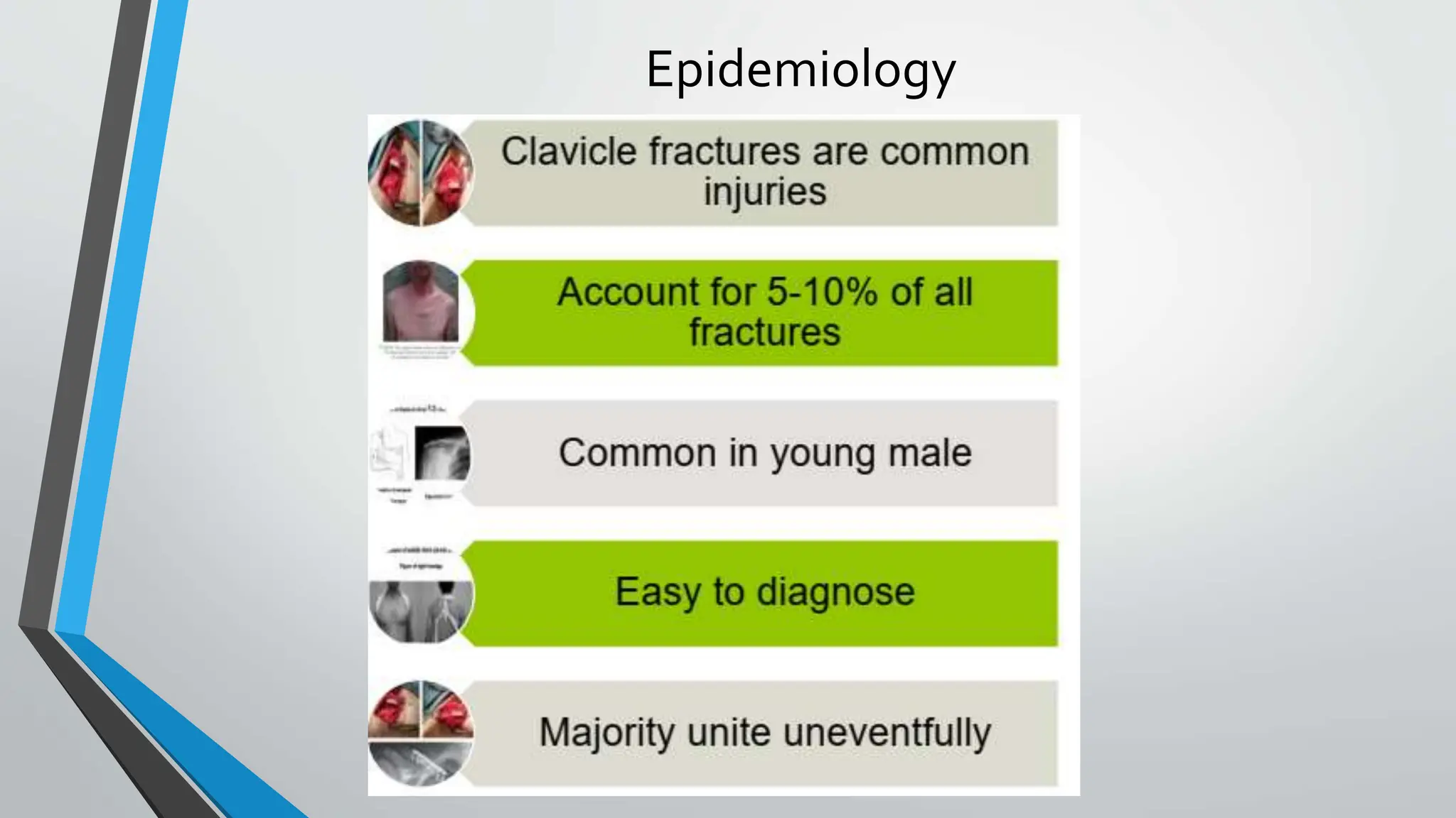 managements of the clavicle fracture.pptx