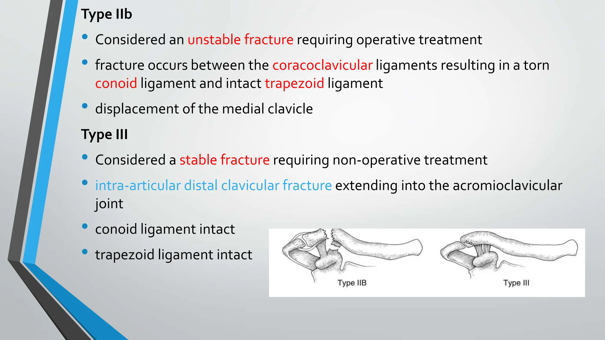 managements of the clavicle fracture.pptx