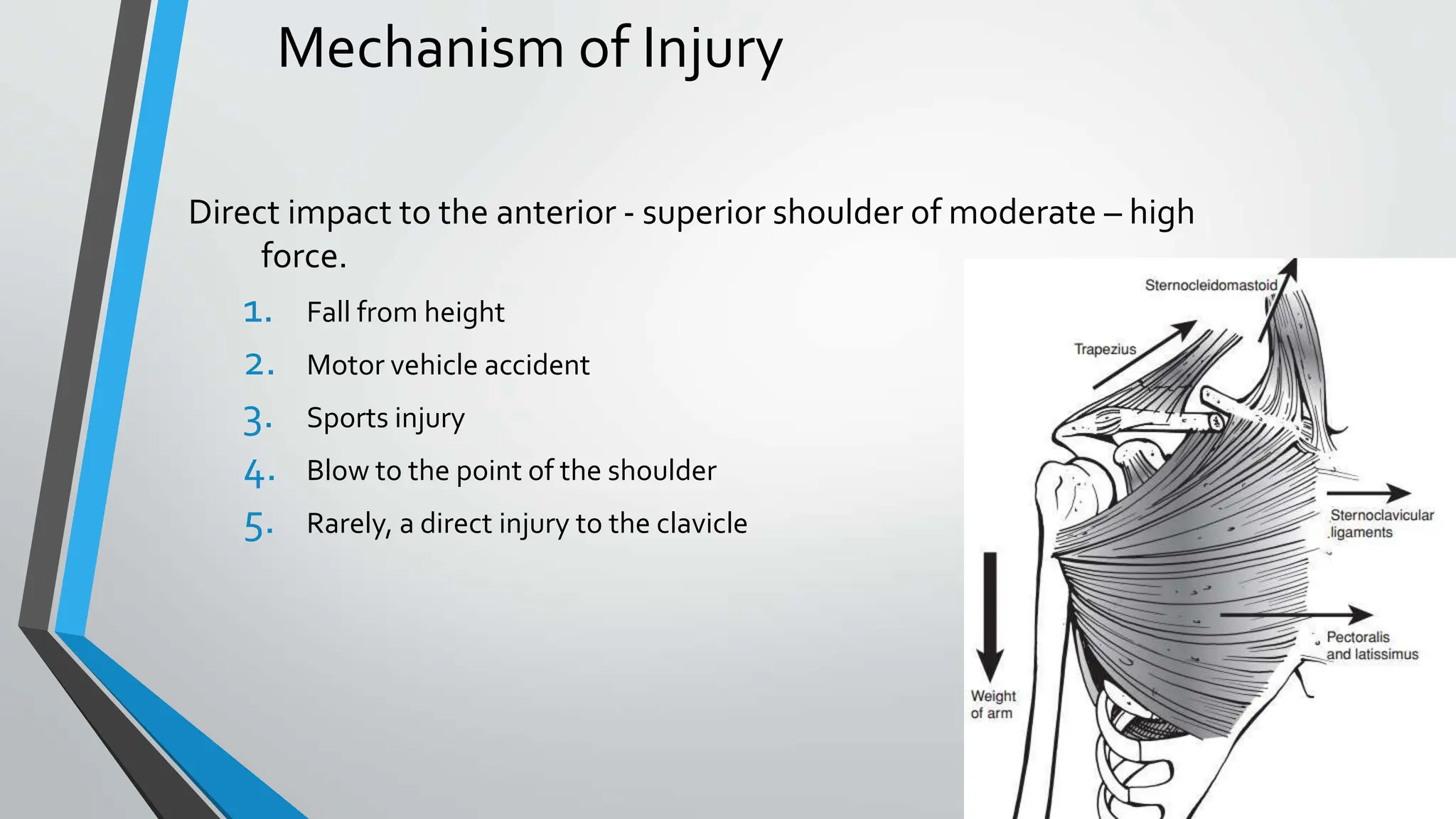 managements of the clavicle fracture.pptx
