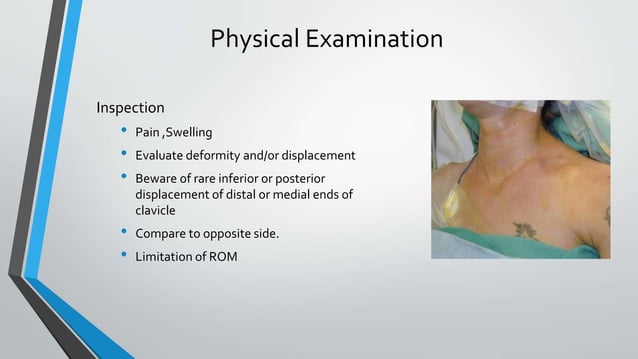 managements of the clavicle fracture.pptx