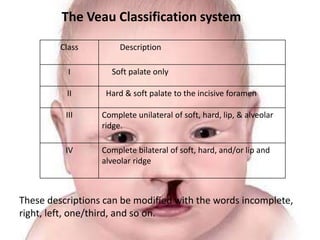 Management of cleft lip and palate | PPTX
