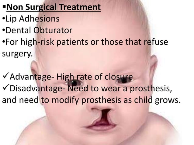 Management of cleft lip and palate | PPT