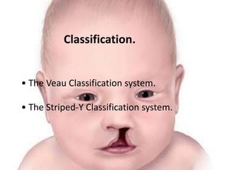Management of cleft lip and palate | PPT