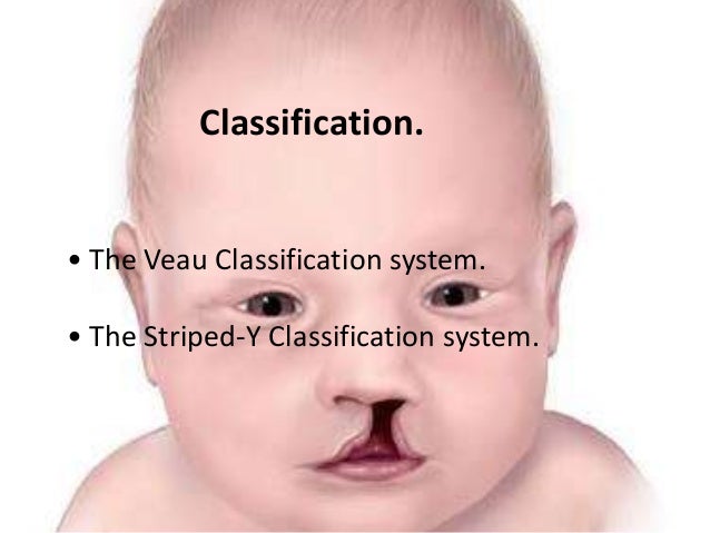 Management of cleft lip and palate
