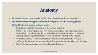 Management of cleft lip and palate | PPTX