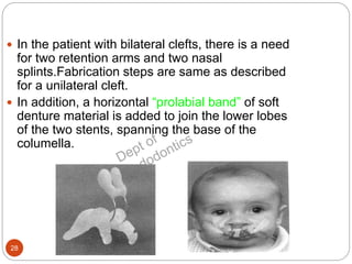 Management of cleft lip and palate | PPTX