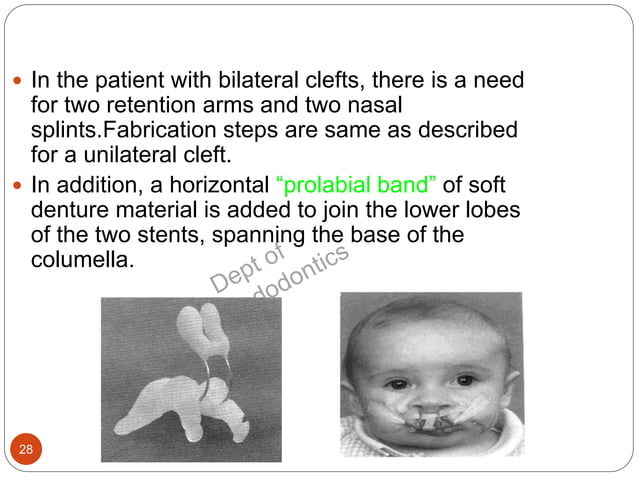 Management of cleft lip and palate | PPTX | Ear, Nose and Throat ...