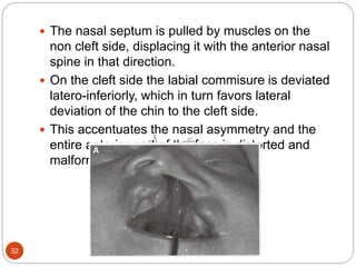 Management of cleft lip and palate | PPTX