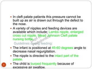 Management of cleft lip and palate | PPTX