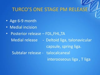 Management of club foot | PPTX