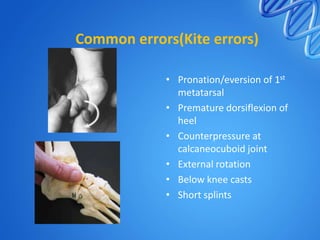 Management of club foot | PPTX