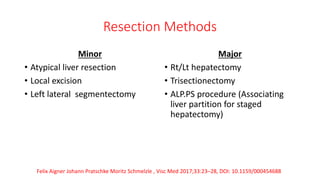 Management of colorectal liver metastasis | PPTX