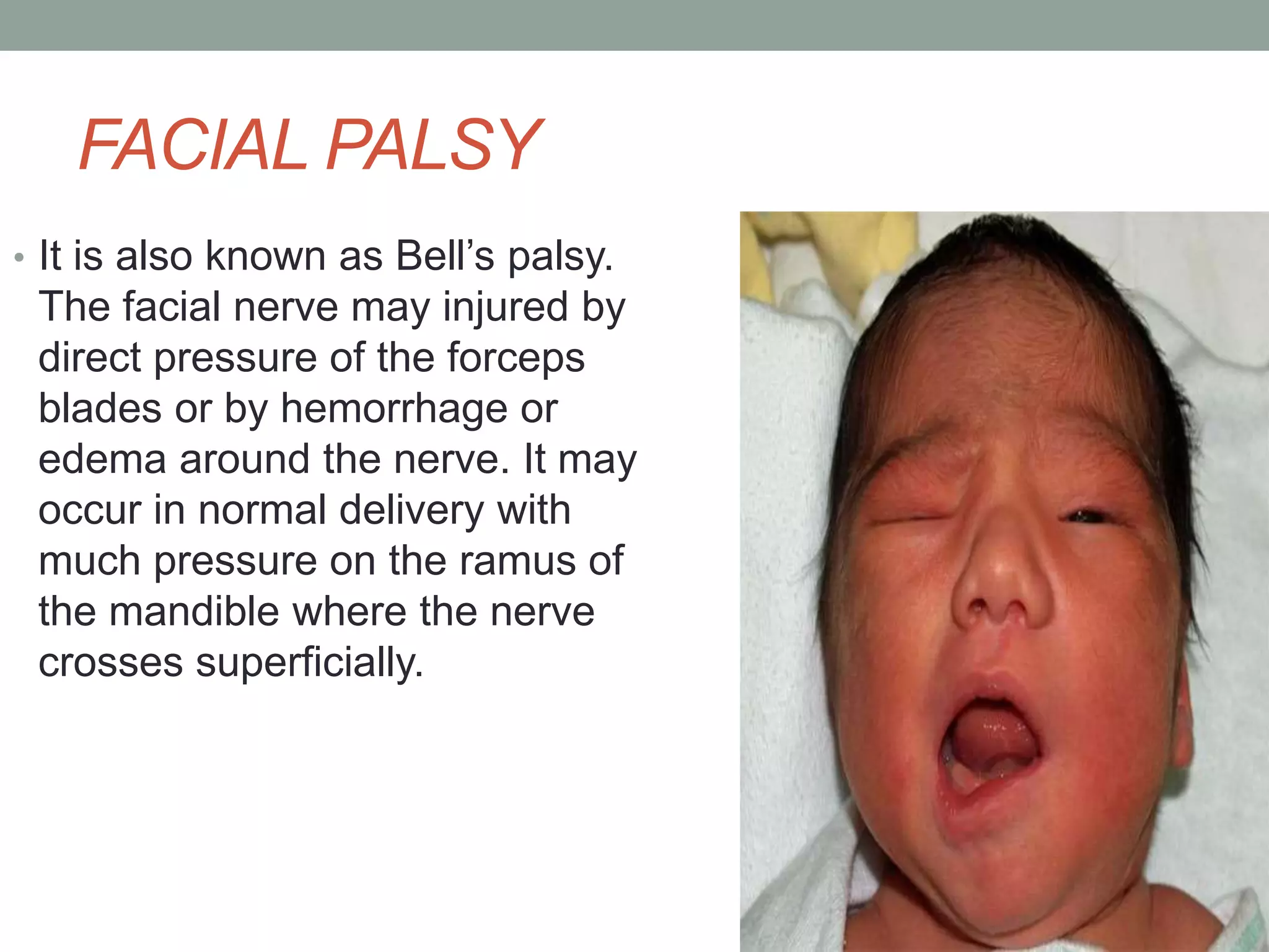 Management of common neonatal disorders | PPTX